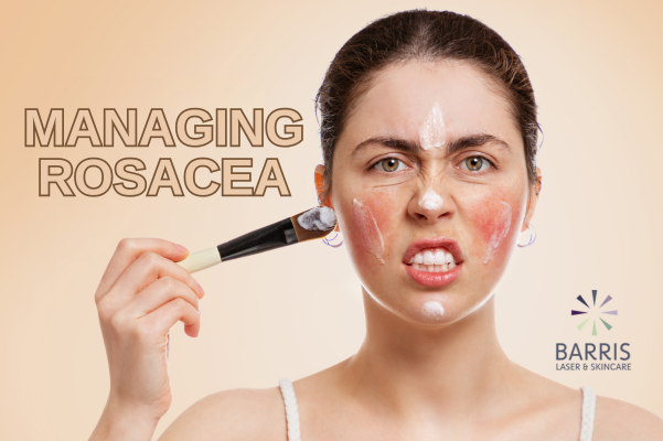 Managing Rosacea Barris Laser & Skincare - Barris Laser & Skin Care ...